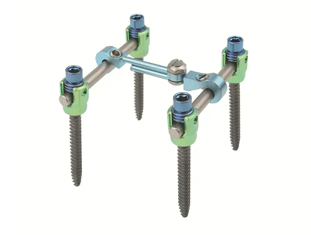 Understanding Interlaminar Spinal Fixation Systems – annakalita